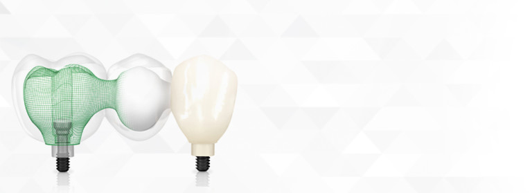 Chi Siamo - MP LAB - Laboratorio Odontotecnico